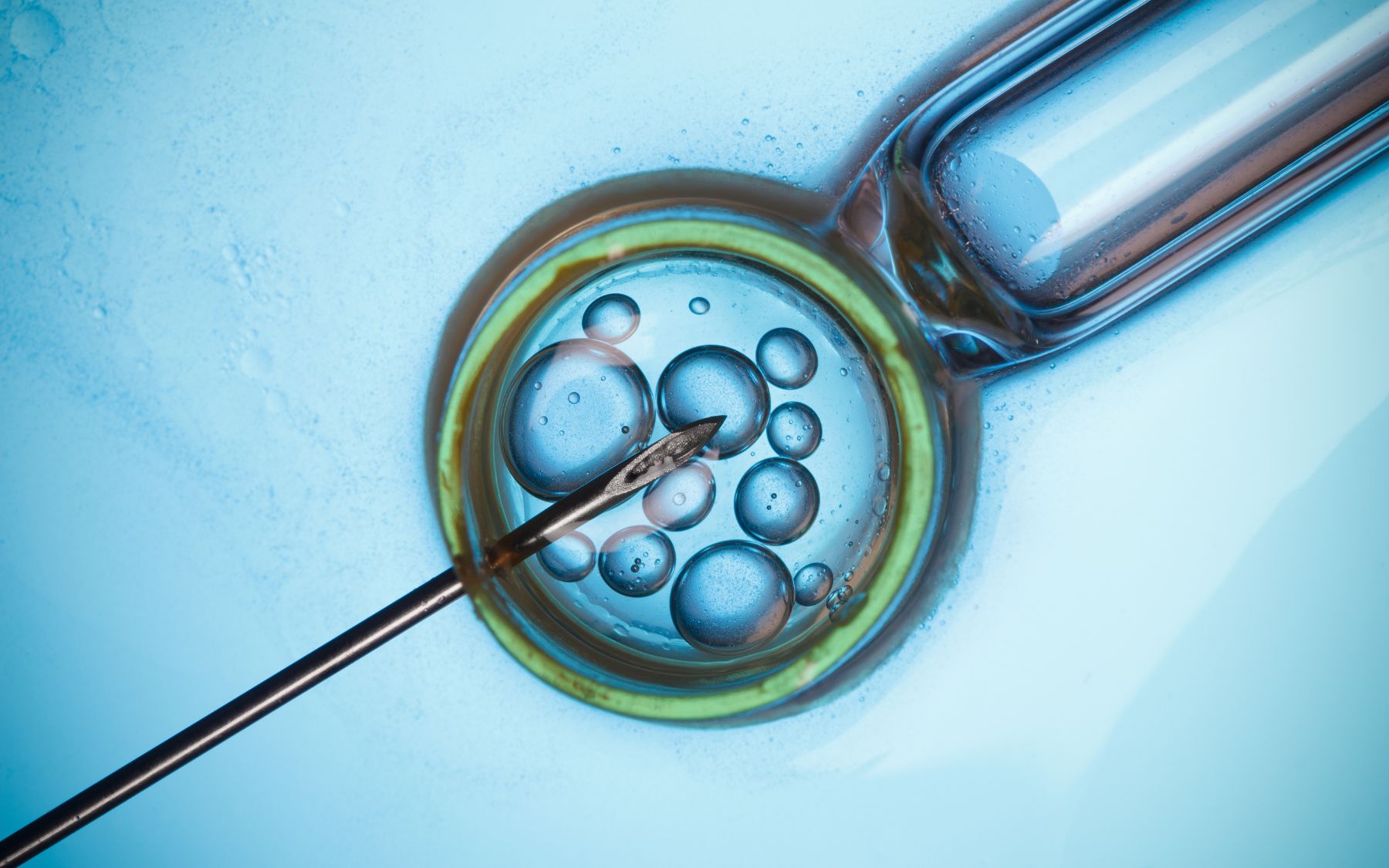 Micro-TESE sperm retrieval - Urology Clinics Manchester